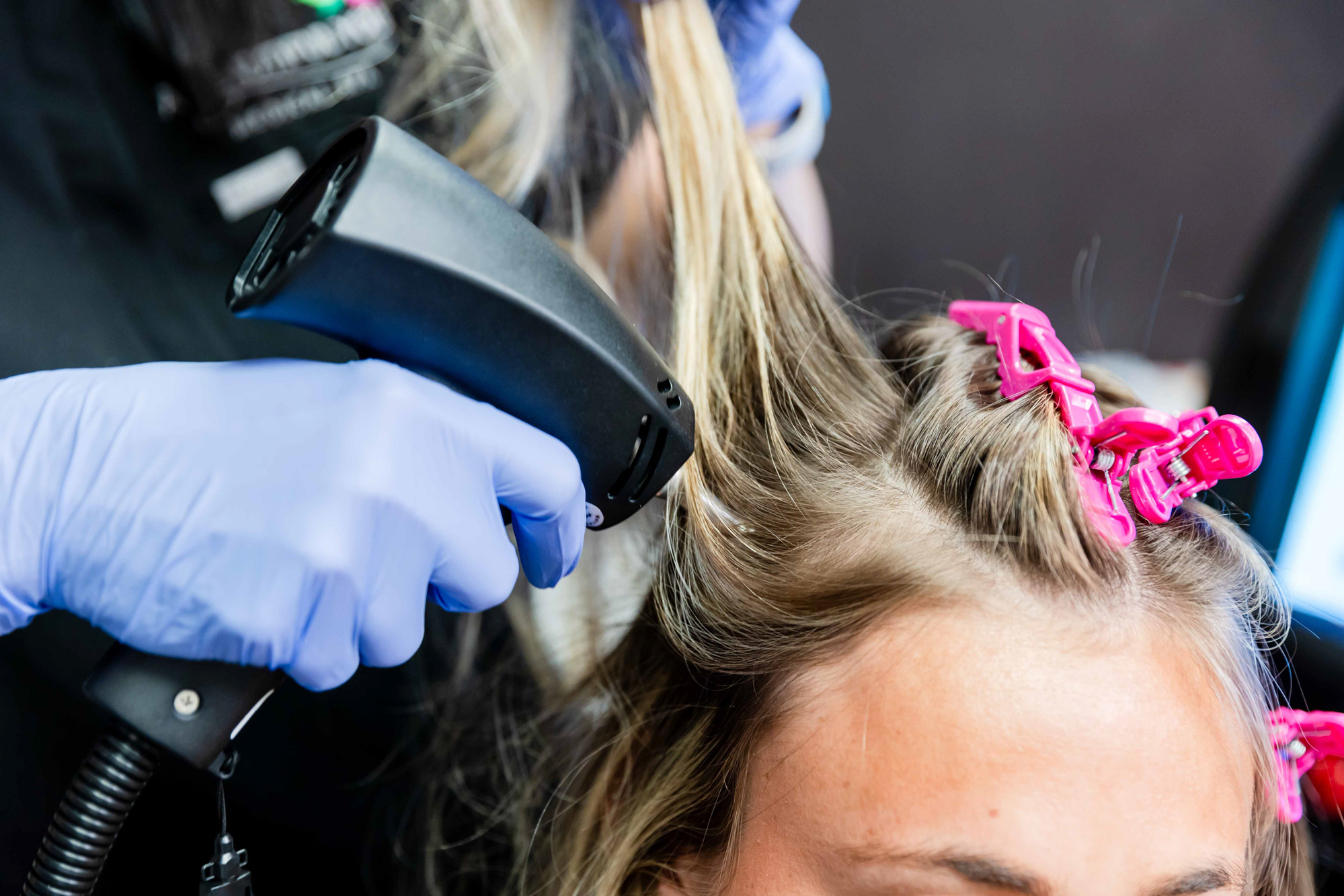 TED Hair Restoration - A Beautiful You Medical Spa